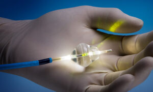 Laser Advances in Urology: Revolutionary Treatments for Prostate ...